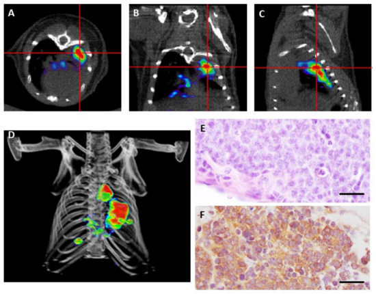 Cancers | Free Full-Text | Neuroendocrine Lung Cancer Mouse Models: An ...